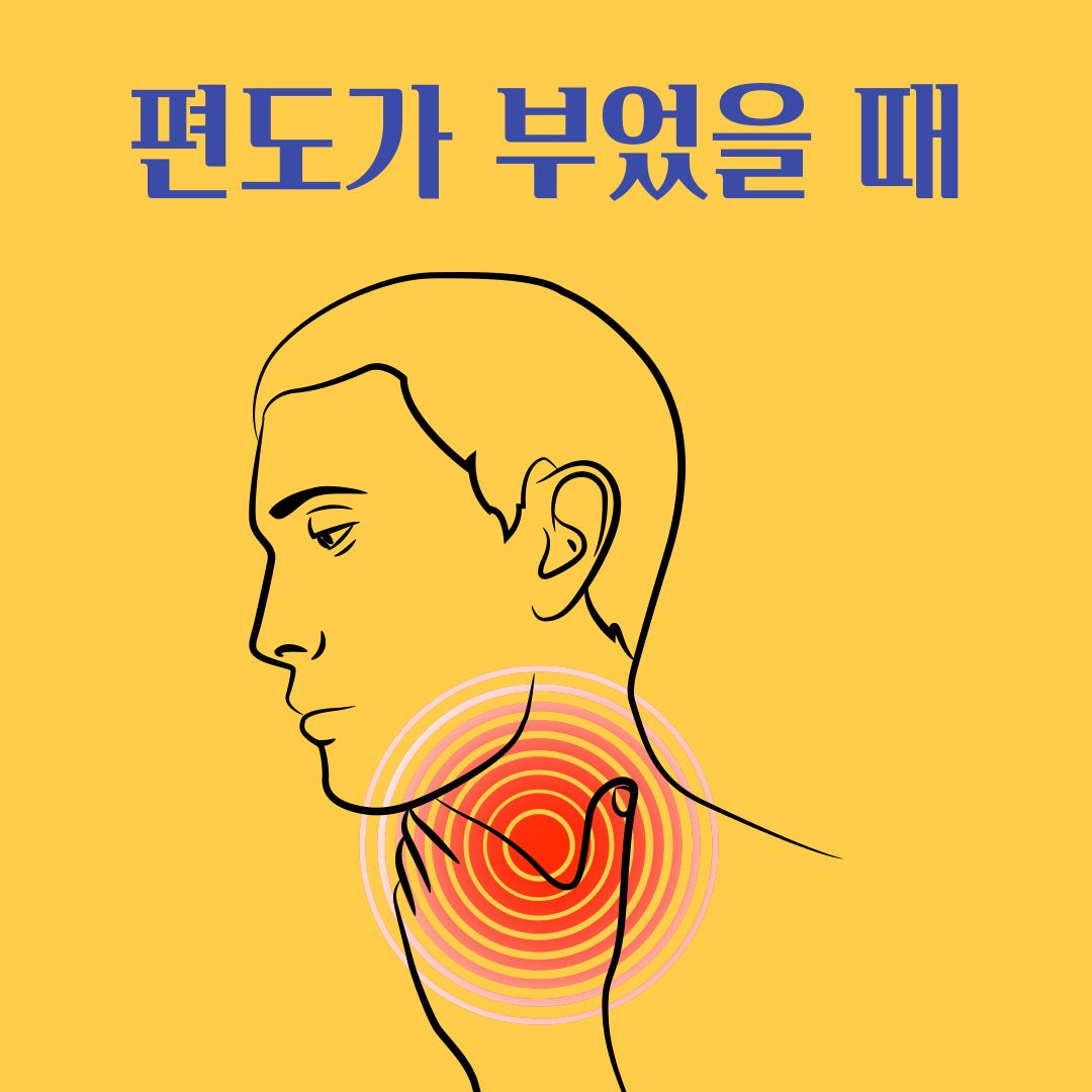 편도 부었을 때 만성ㆍ급성 편도선염편도염 증상감기랑 차이점 네이버 포스트