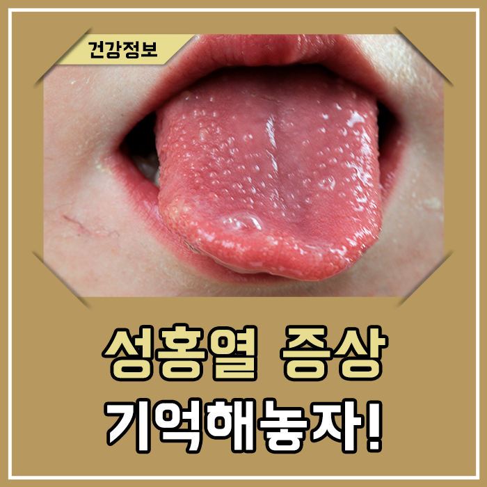 성홍열 증상 기억해놓자 네이버 포스트