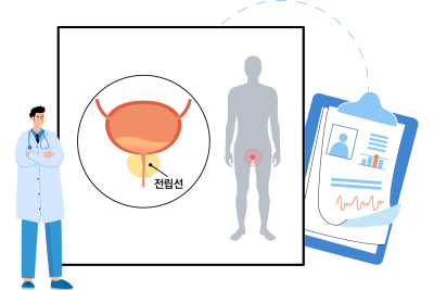 전립선암 인식주간 맞아 알아보는 전립선암 Qanda 6가지 네이버 포스트