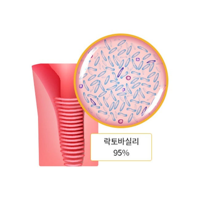 세균성질염 개선에 효과적인 세균성질염 치료 유산균 선택하는 방법 네이버 포스트