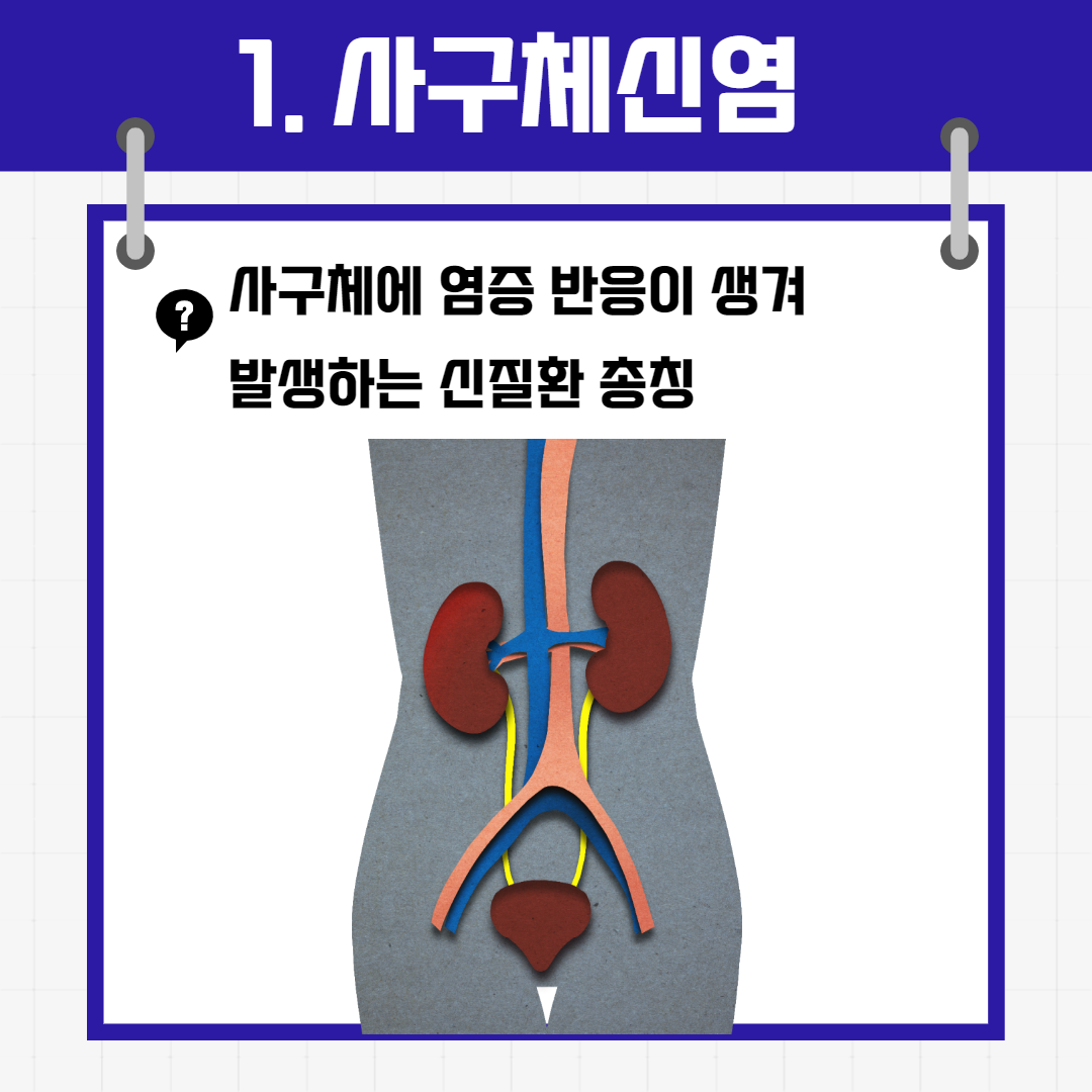 신장질환 신장염 증상 원인 급성 사구체신염 신우신염 콩팥 신장 결석 통증 네이버 포스트