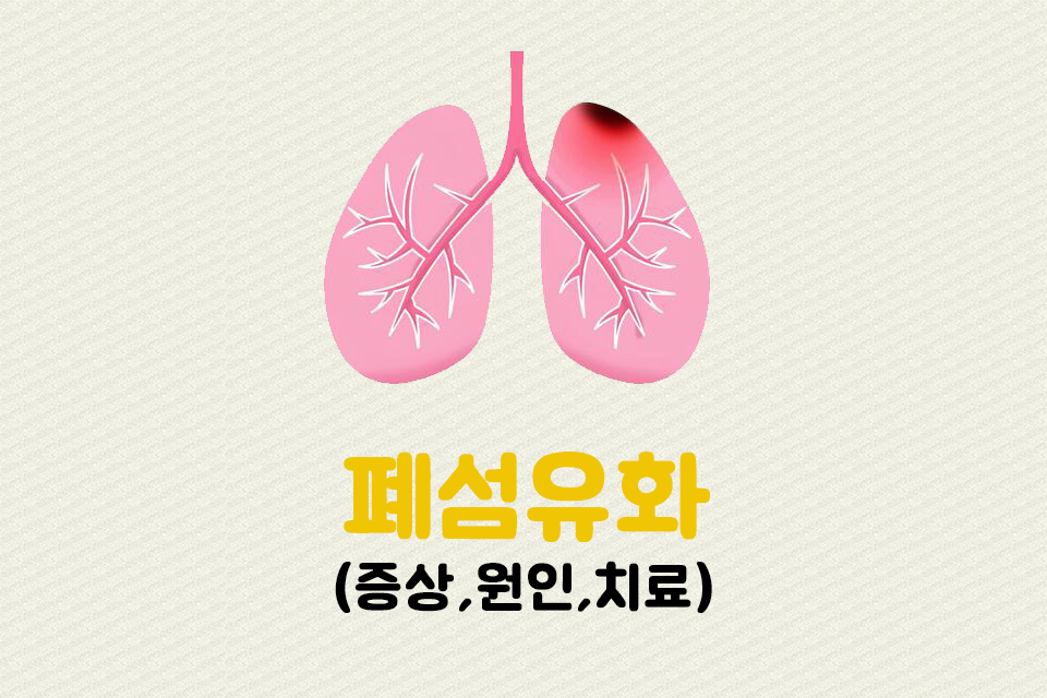 폐섬유화 증상 원인 치료 폐질환 알아보기 네이버 포스트