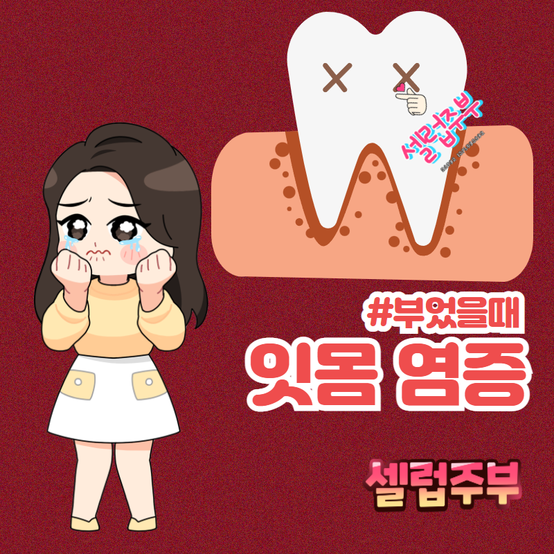 잇몸 염증 부었을때 구내염 출혈 시림 원인 및 치료법 네이버 포스트