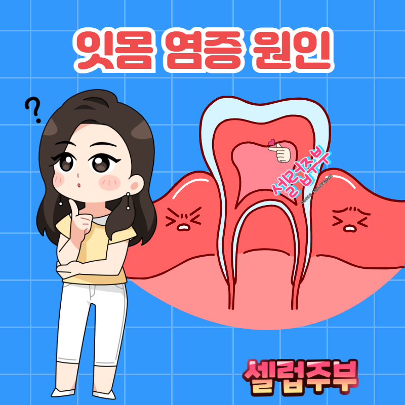 잇몸 염증 부었을때 구내염 출혈 시림 원인 및 치료법 네이버 포스트
