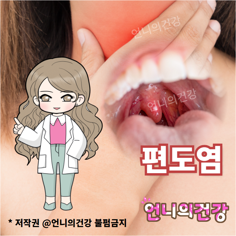 편도 부었을때 약 5종류와 편도염 원인 증상 알아봐요 정보력