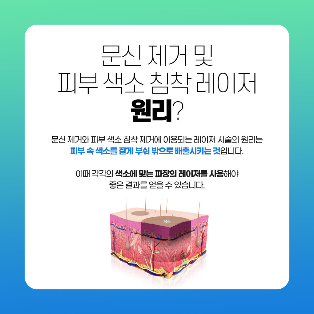피부 색소 침착 레이저 문신 제거 피부과에서 받기 전에 알아봐야 할 점 네이버 포스트