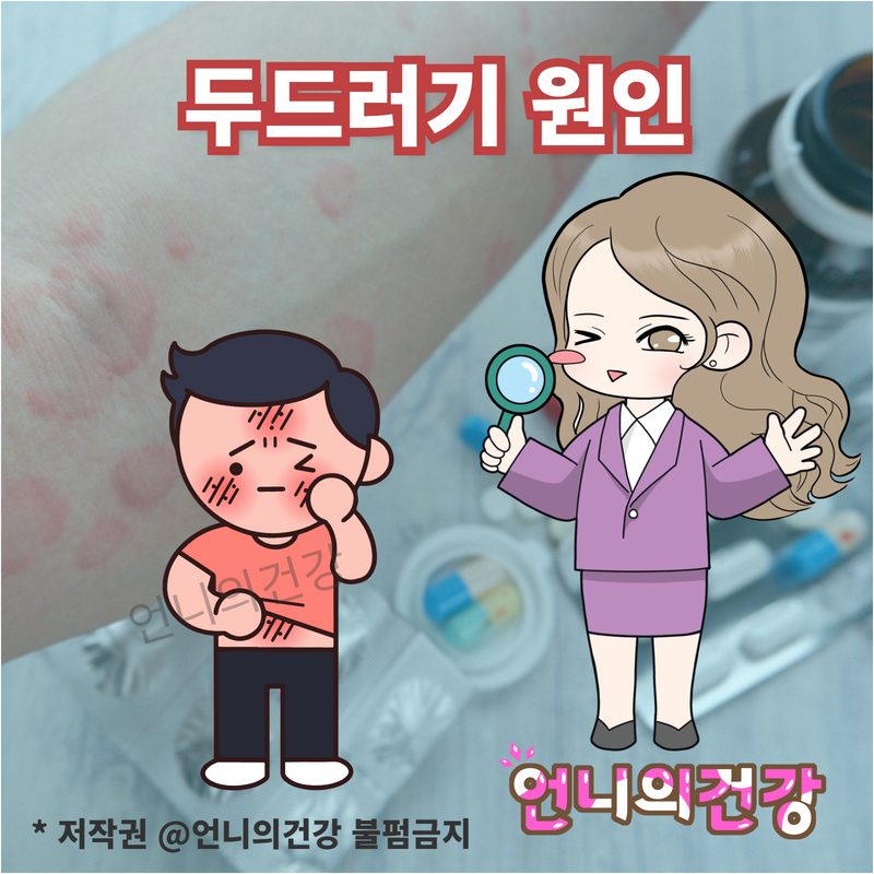 두드러기 증상 원인 및 치료법 네이버 포스트