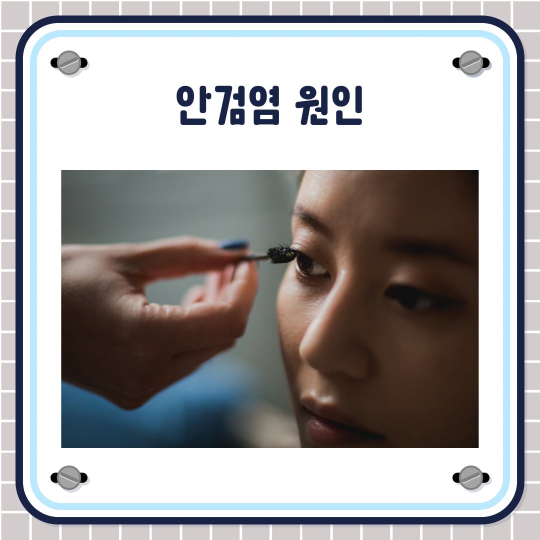 안검염눈꺼풀여드름 눈이물감 눈기름샘청소 네이버 포스트