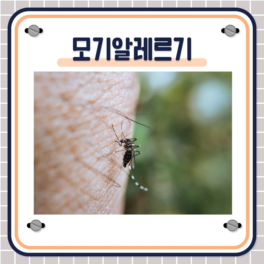모기 물렸을때 모기알레르기스키터증후군모기안물리는법 일본뇌염모기 네이버 포스트
