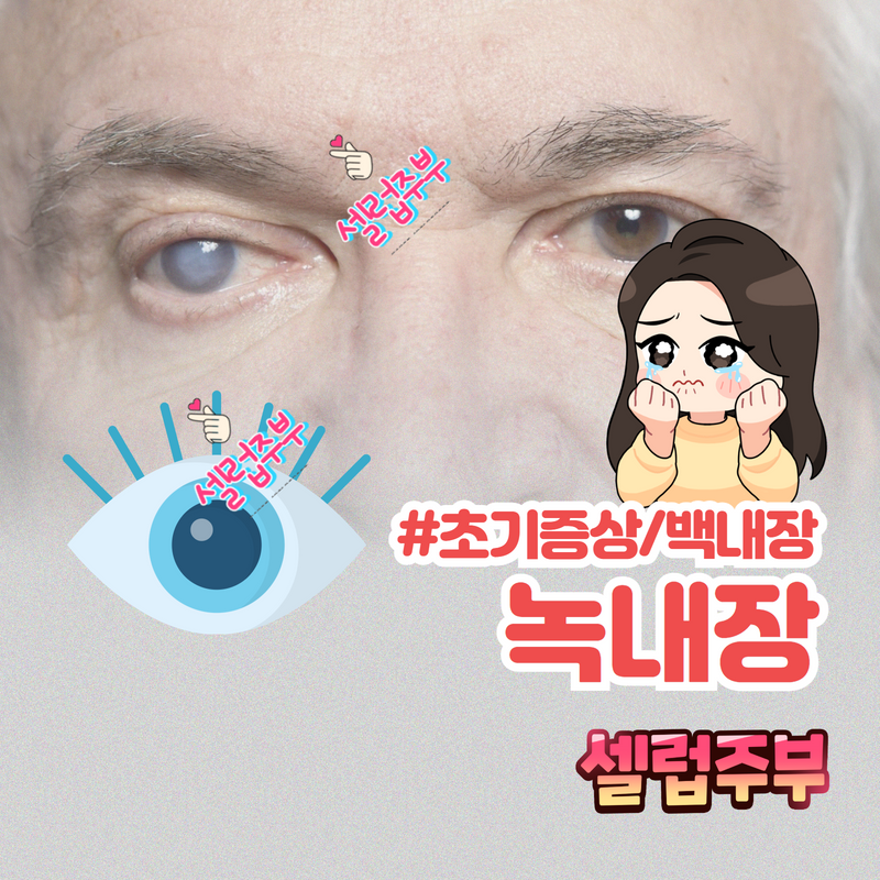 녹내장 초기증상 백내장 원인20대30대 치료법 네이버 포스트