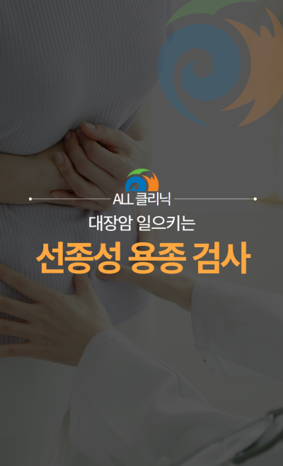 대장암 일으키는 선종성 용종 검사와 예방법은 네이버 포스트