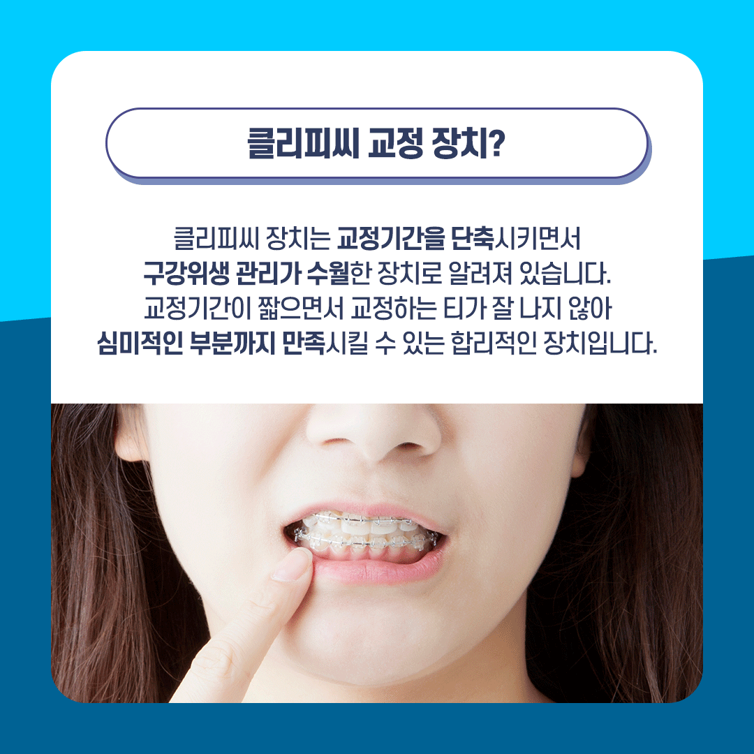 치과 치아교정 빠를수록 좋을까 클리피씨 장점 알아보기 네이버 포스트
