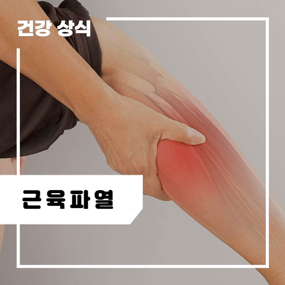 근육파열 증상 및 원인과 치료 종아리 허벅지 어깨 팔 네이버 포스트