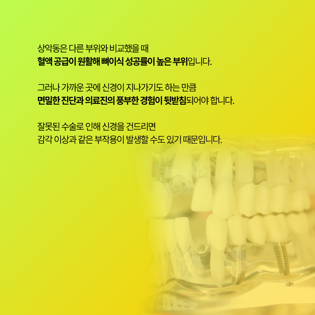 치과 임플란트 치조골 부족할 때 뼈이식 임플란트와 상악동 거상술 네이버 포스트