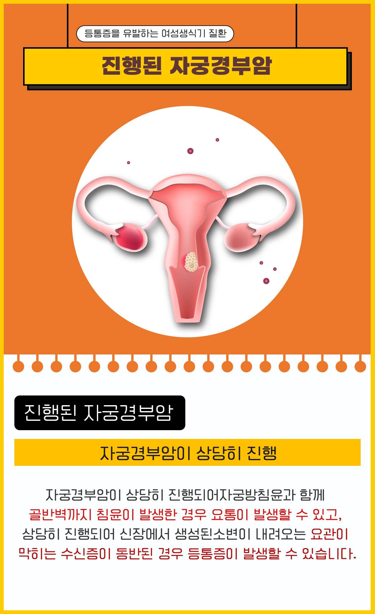 등통증을 유발하는 여성생식기 질환 네이버 포스트