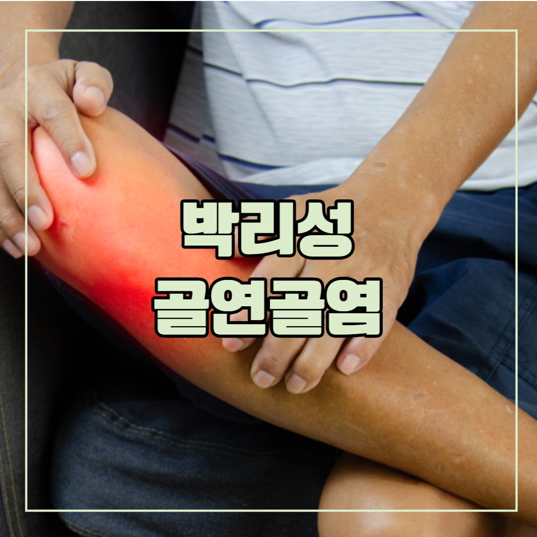 무릎 박리성 골연골염 증상 원인 치료 무릎관절통증 네이버 포스트