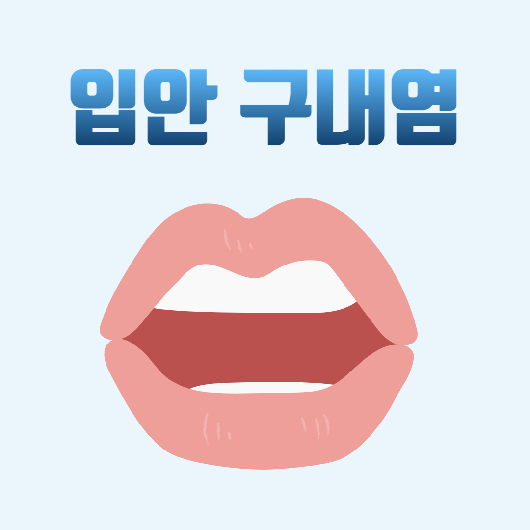 입안 구내염 증상 입술·잇몸 편도 혓바닥 입천장 헐었을때 구내염 원인 네이버 포스트