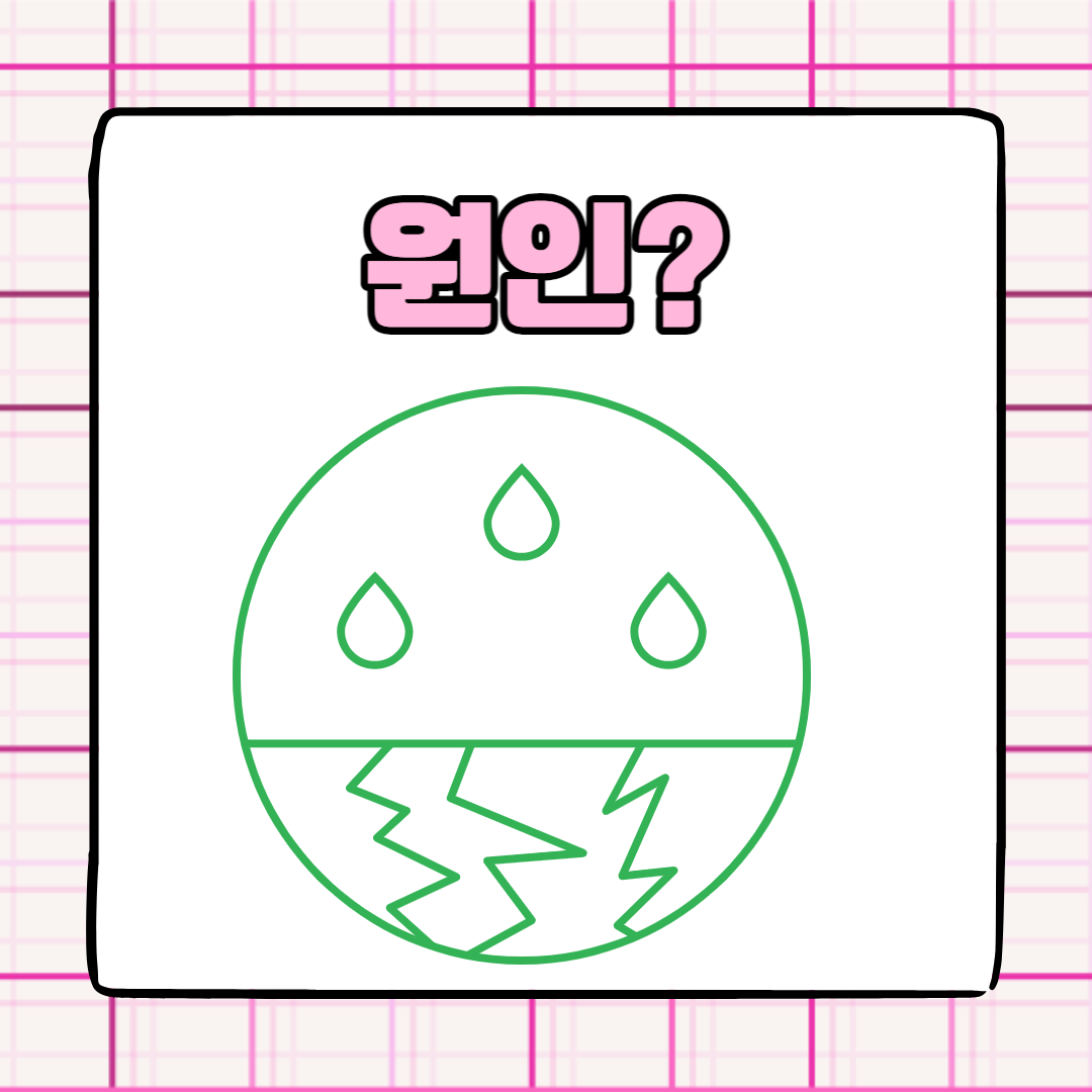 피부건선증상은 얼굴부터 두피 손톱 발톱 파임 변형까지 네이버 포스트
