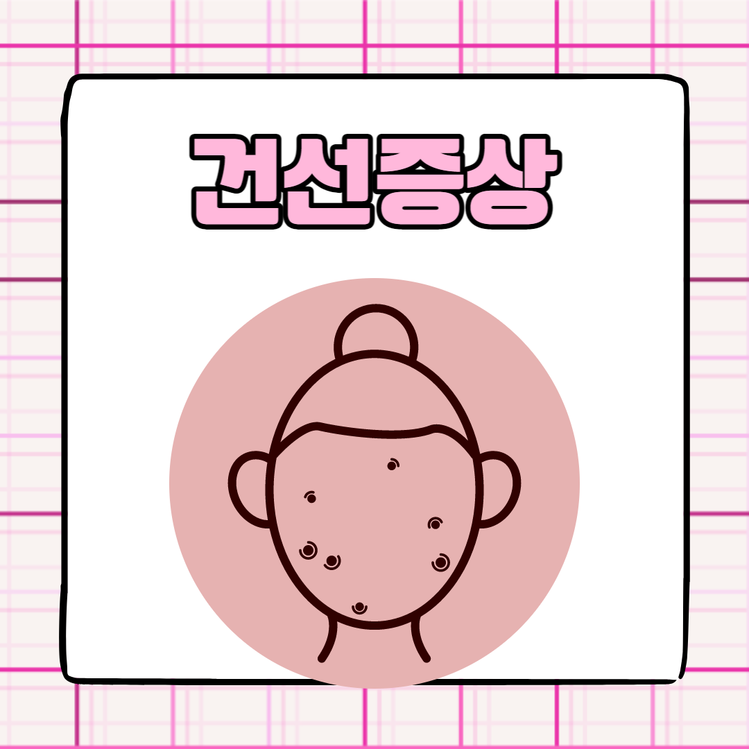 피부건선증상은 얼굴부터 두피 손톱 발톱 파임 변형까지 네이버 포스트