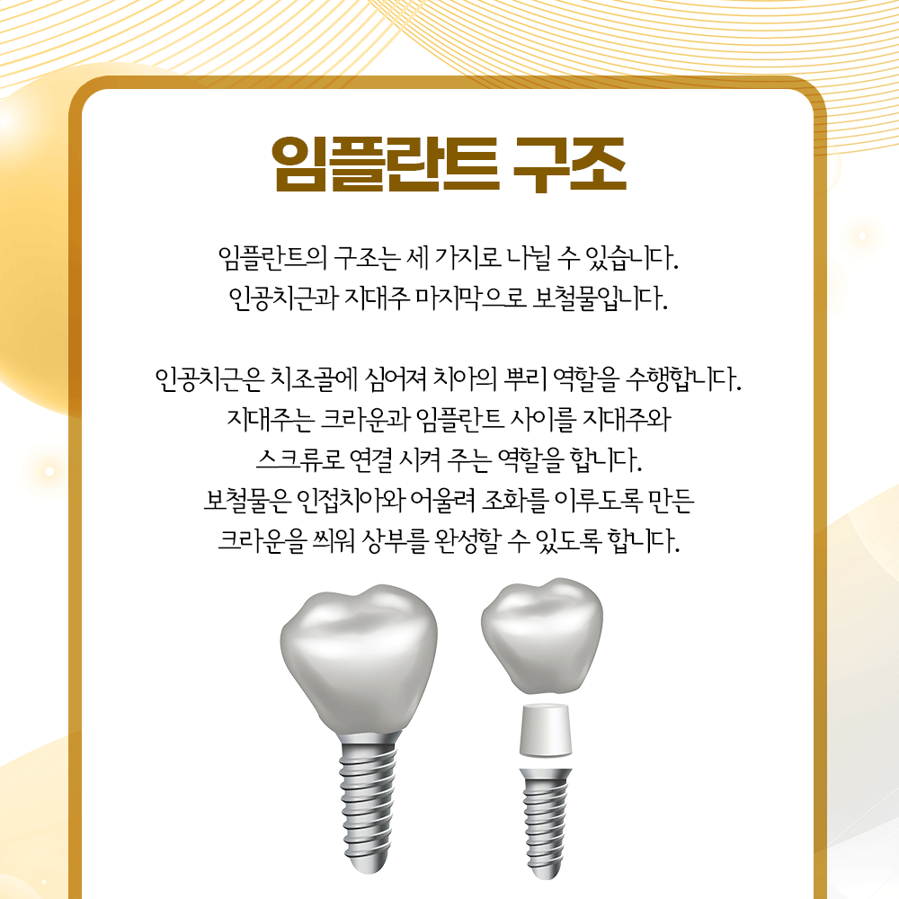 분당치과 임플란트 치과 찾을 때 알아보세요 네이버 포스트