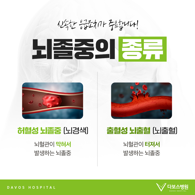 뇌졸중전조증상 의심된다면 검사받아요 네이버 포스트